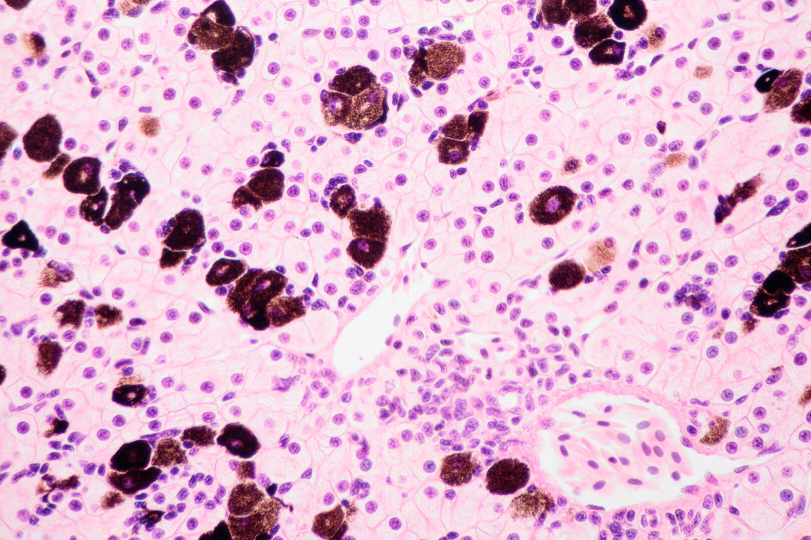 Deep dive: Cultivated meat cell lines | GFI