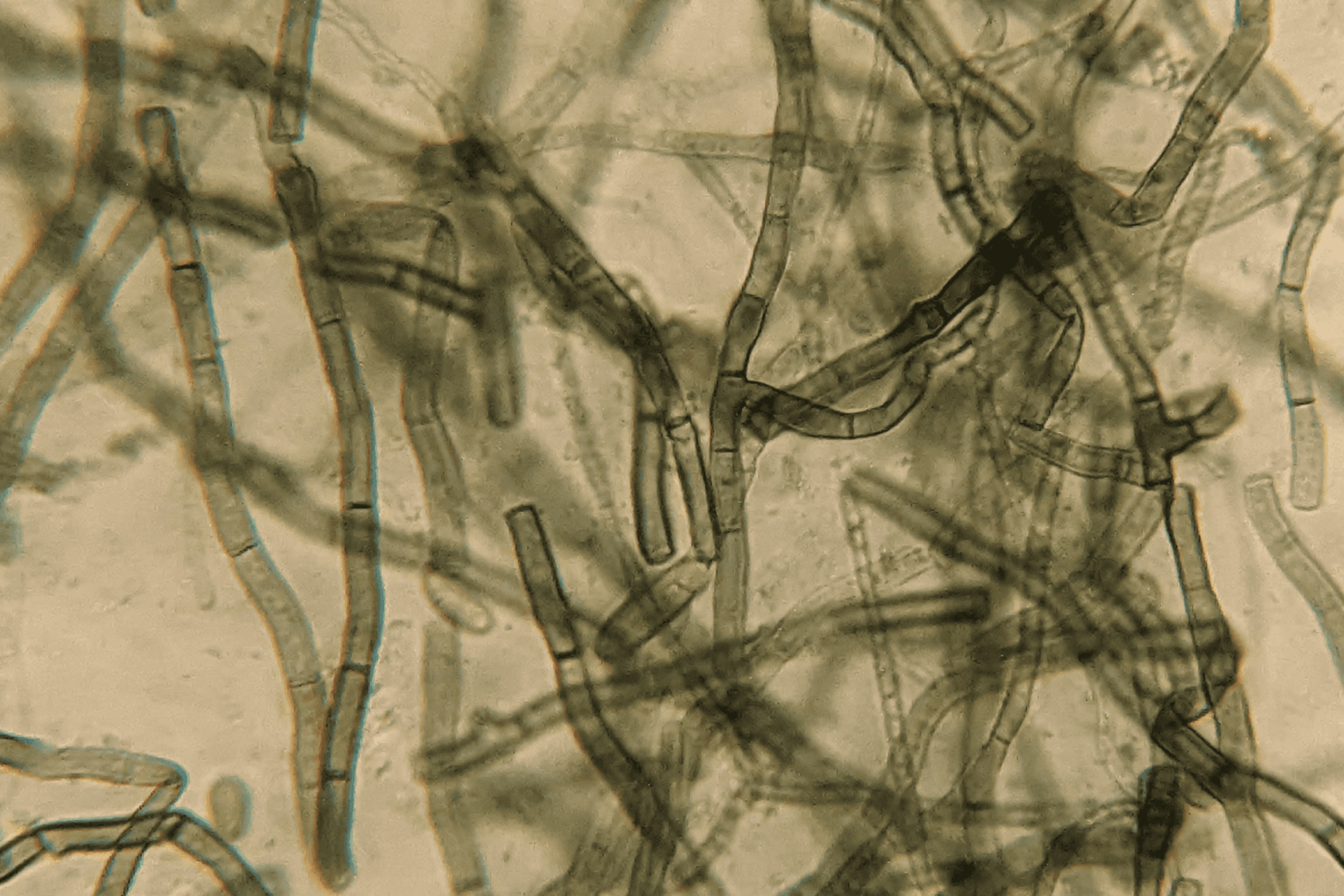 The Science of Alt Protein: Producing Fungi-Based Foods — Alternative ...